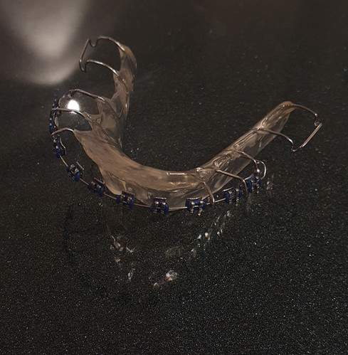 Retainer with Brackets | Ortho Couture