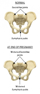 Symphysis Pubis Dysfunction, SPD.