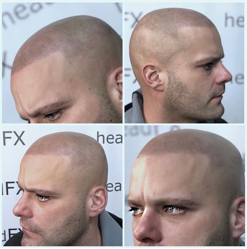 Perfect Hair Line (SMP)