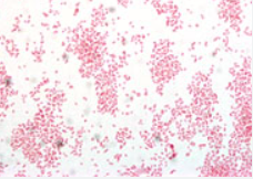 DL-997: What’s Going on with Whooping Cough, 3 CE | CAMLT