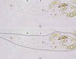 Filamentos mucosos | Hemoformacion3