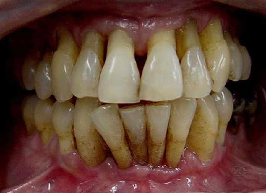 Periodoncia en Lima Perú | Clínica Dental Unlimited