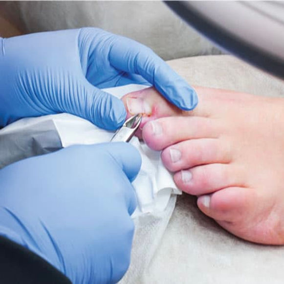 Toenail Surgery Available At Our Clinic