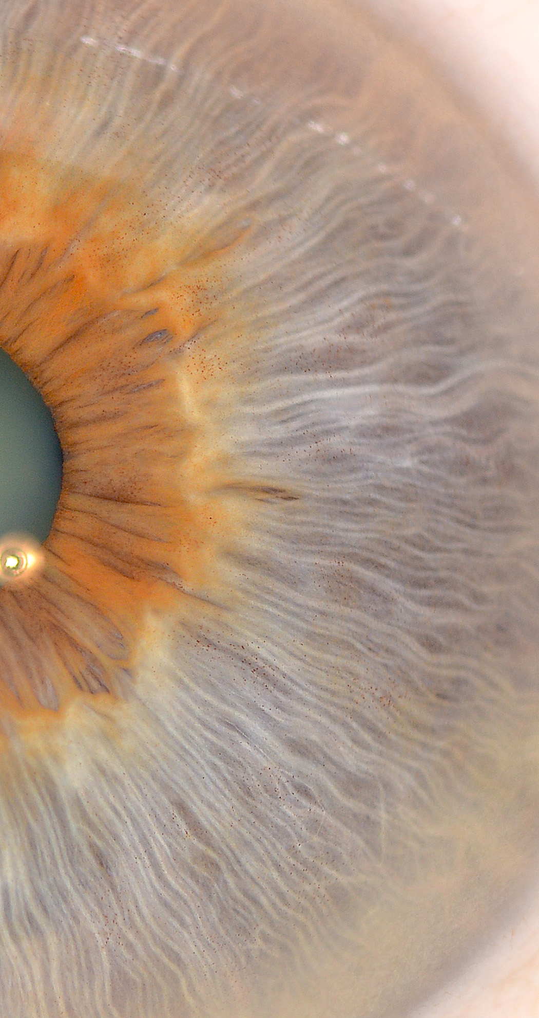 Eye Slices | irisimaging-1