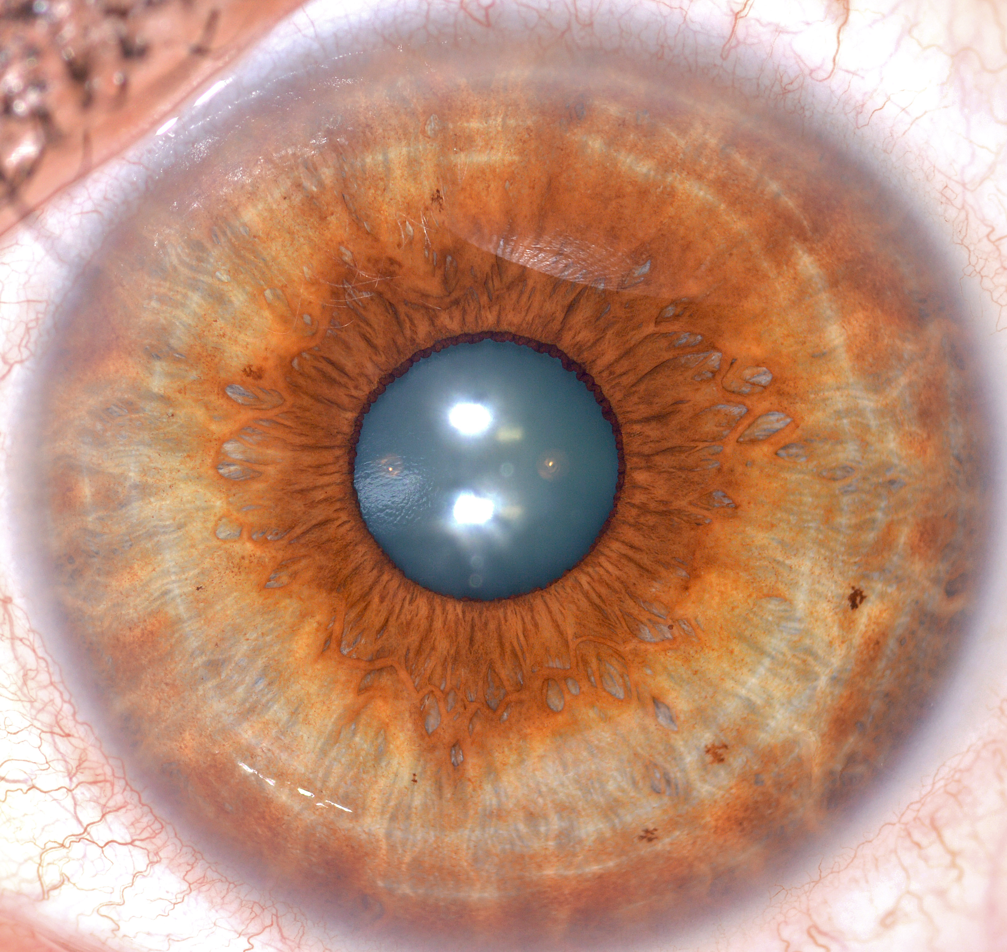 Custom Iridology Camera Systems | Iris Imaging Systems