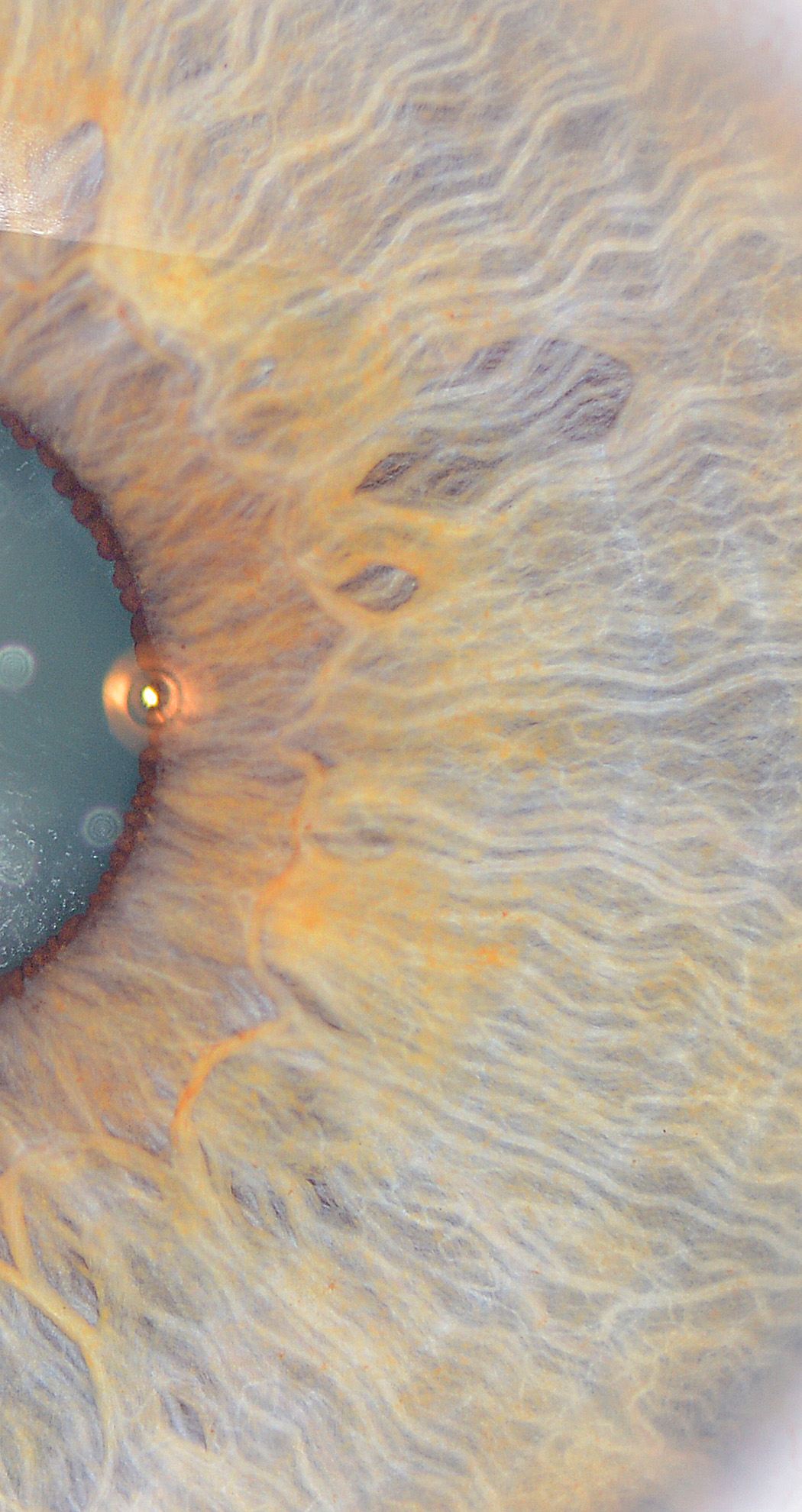 Eye Slices | irisimaging-1