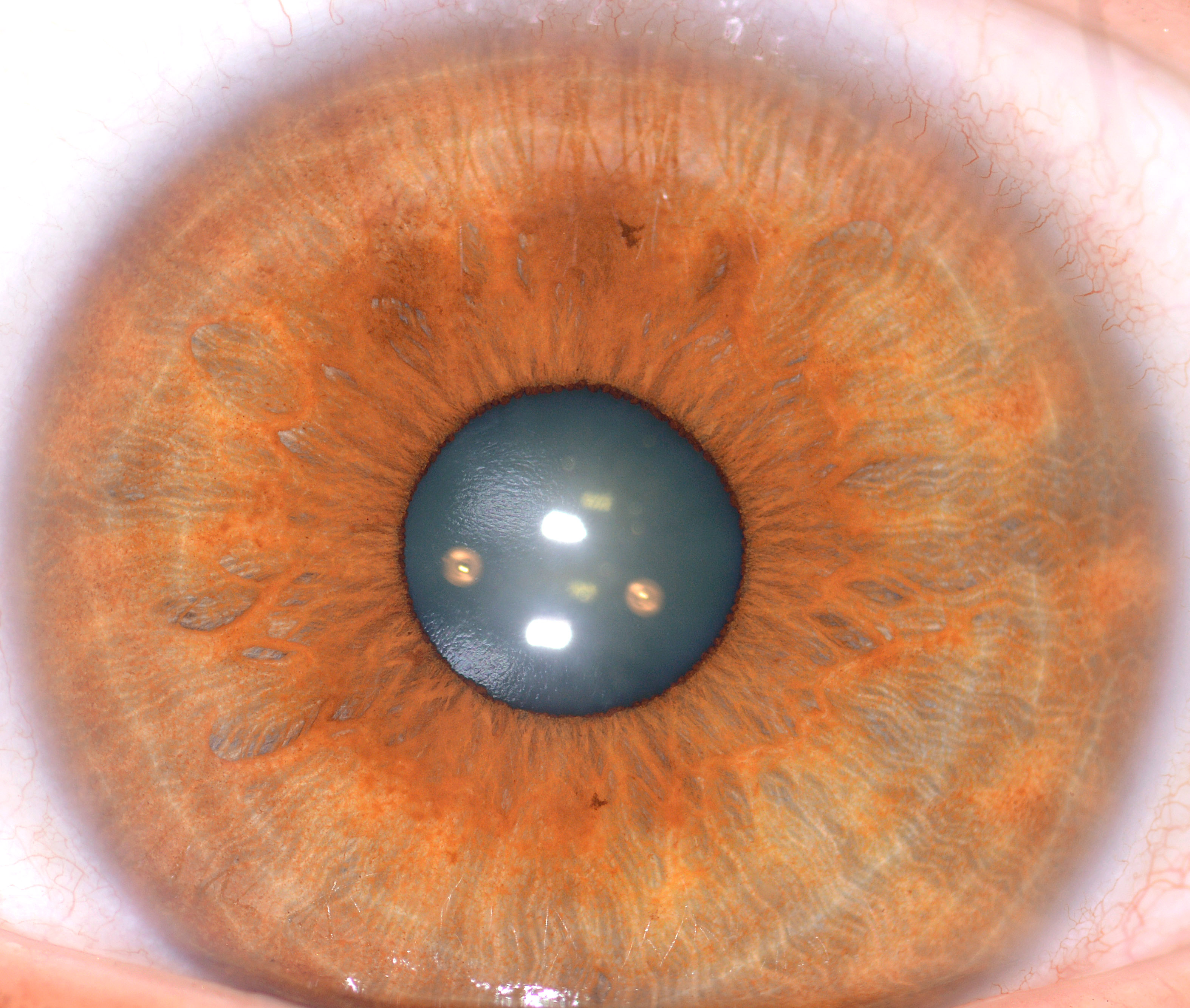 Custom Iridology Camera Systems | Iris Imaging Systems