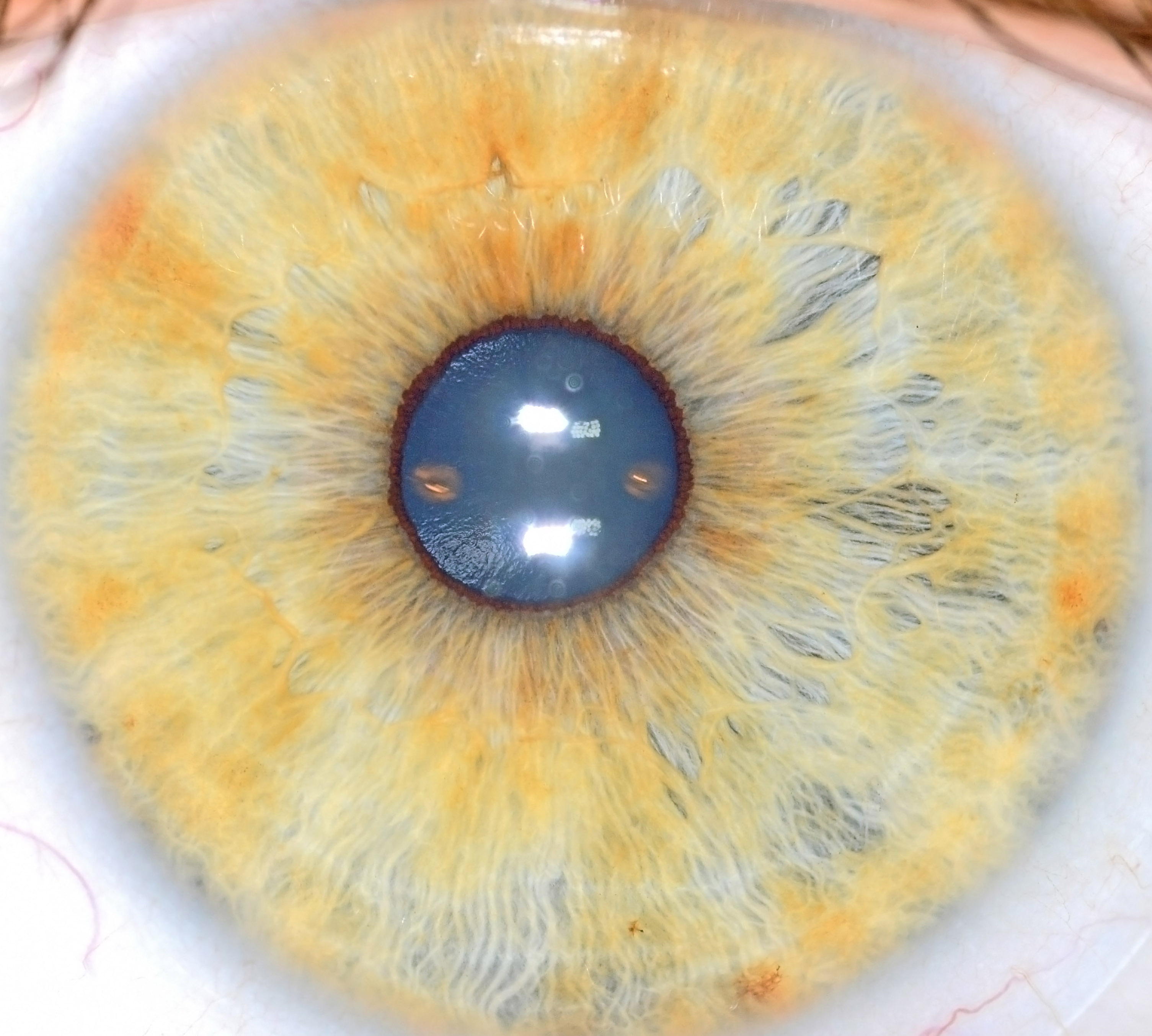 Custom Iridology Camera Systems | Iris Imaging Systems