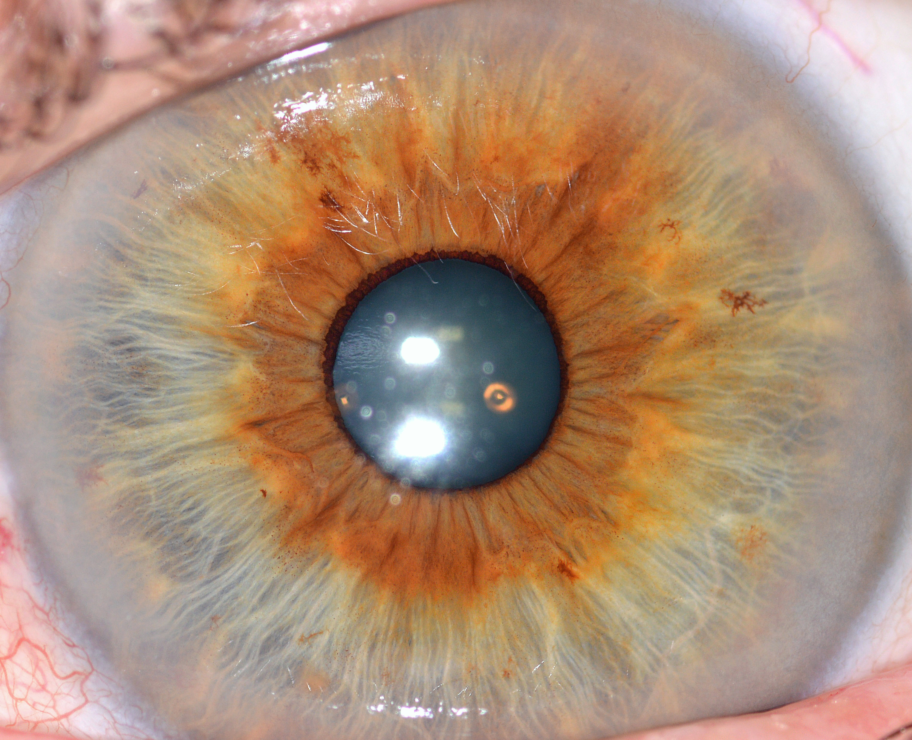 Custom Iridology Camera Systems | Iris Imaging Systems