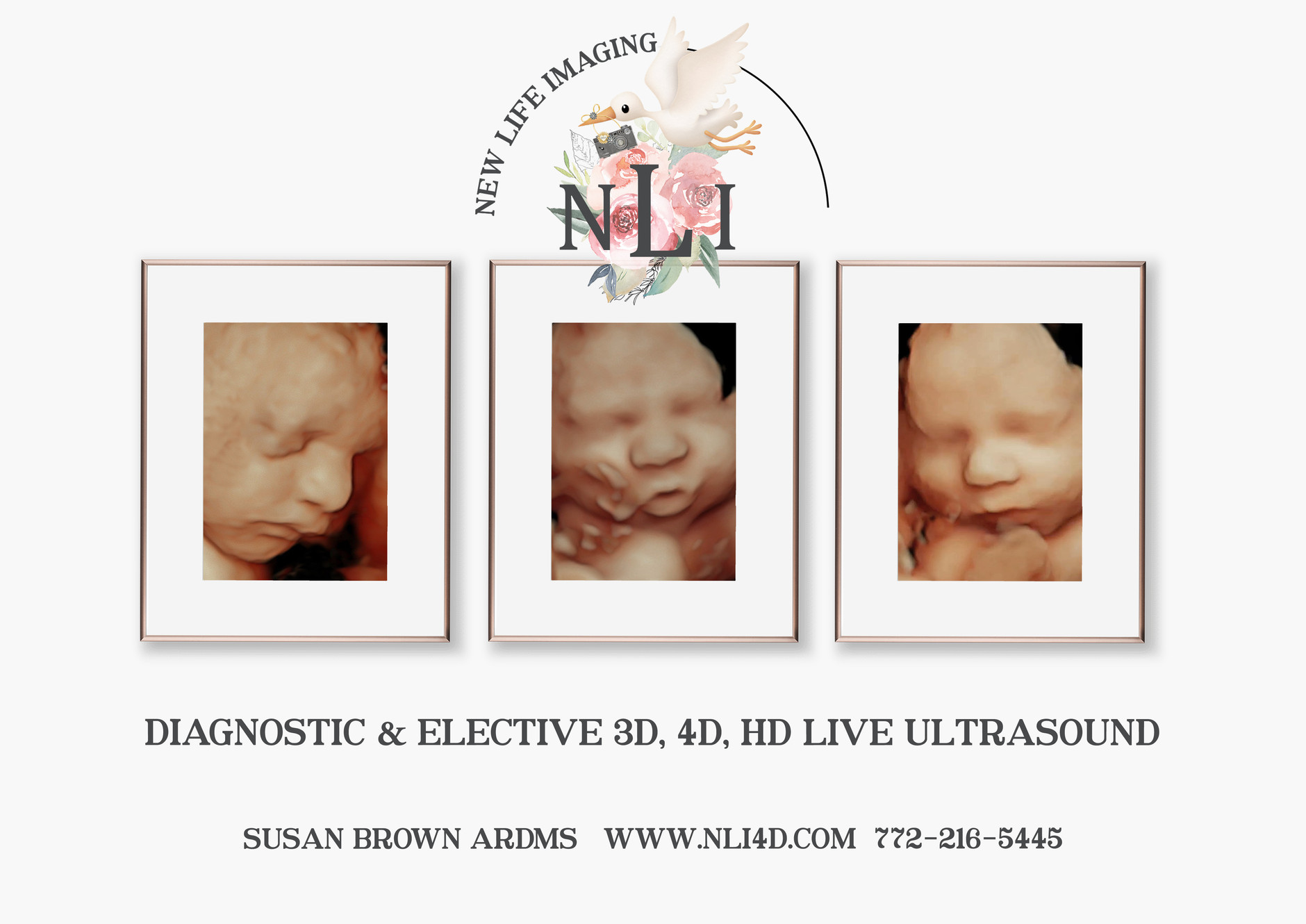 New Life Imaging Ultrasound | 2D 3D 4D 5D HD Live Ultrasound | 735 ...
