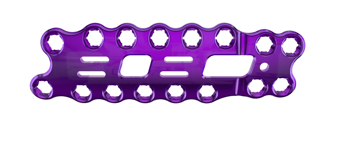 Straddle Plates Gorilla® Medial Column Plating System