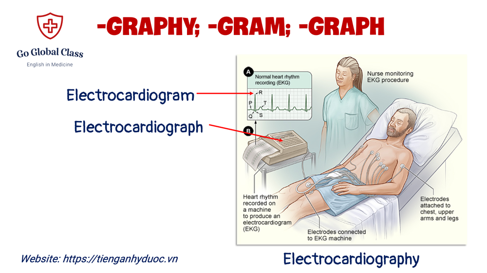 Phân biệt -graphy, -gram và -graph