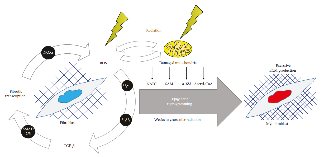 Radiation Therapy | IAA