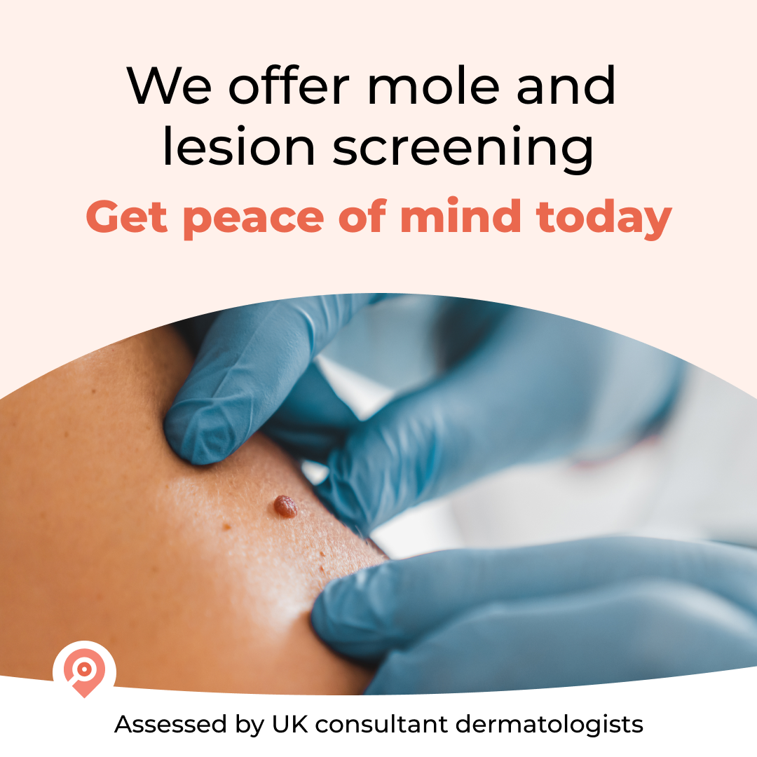 MOLE AND LESION SCREENING