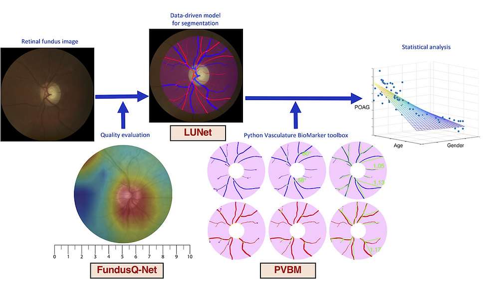 Computerized analysis of the eye vasculature in a mass dataset of ...
