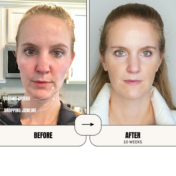 BEFORE & AFTERS | Fit Face X