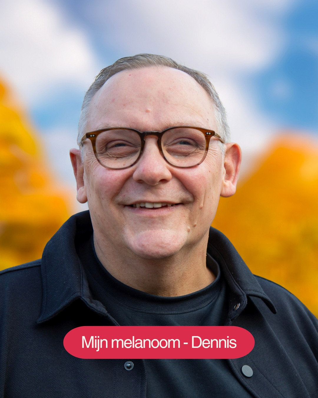 Dennis | Ervaringsverhalen | Stichting Melanoom