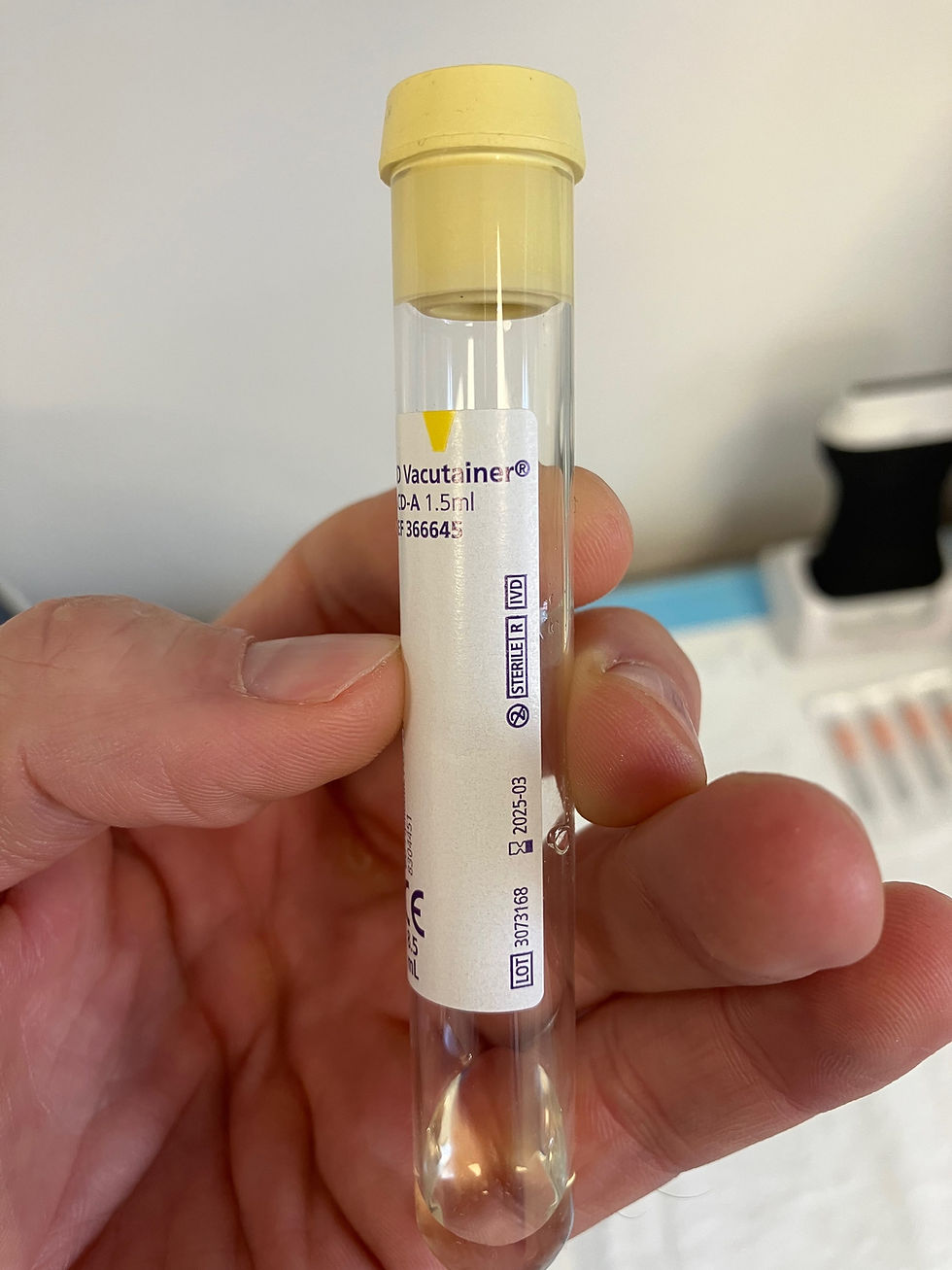 Make sure you are having the correct PRP treatment & how to avoid ...