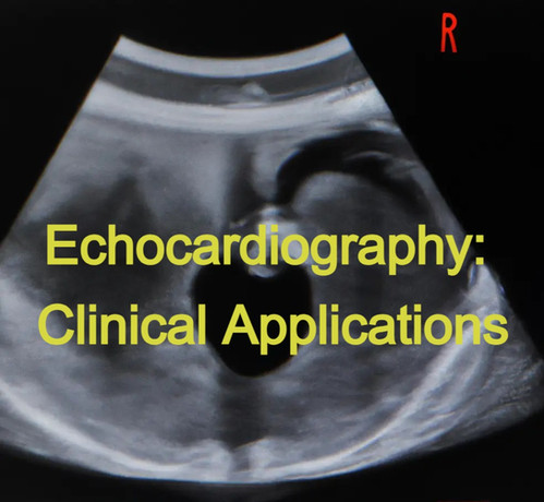 15CME Echocardiography: Clinical Applications 🏷️On Sale: 25% Off ...
