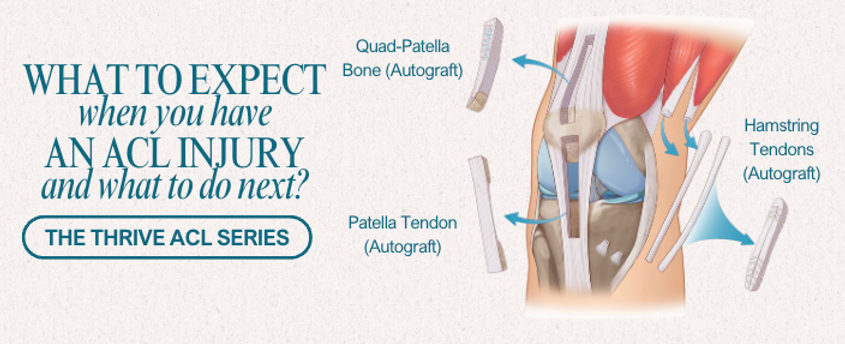 Understanding ACL Injuries: Road to Recovery and Return to Sport