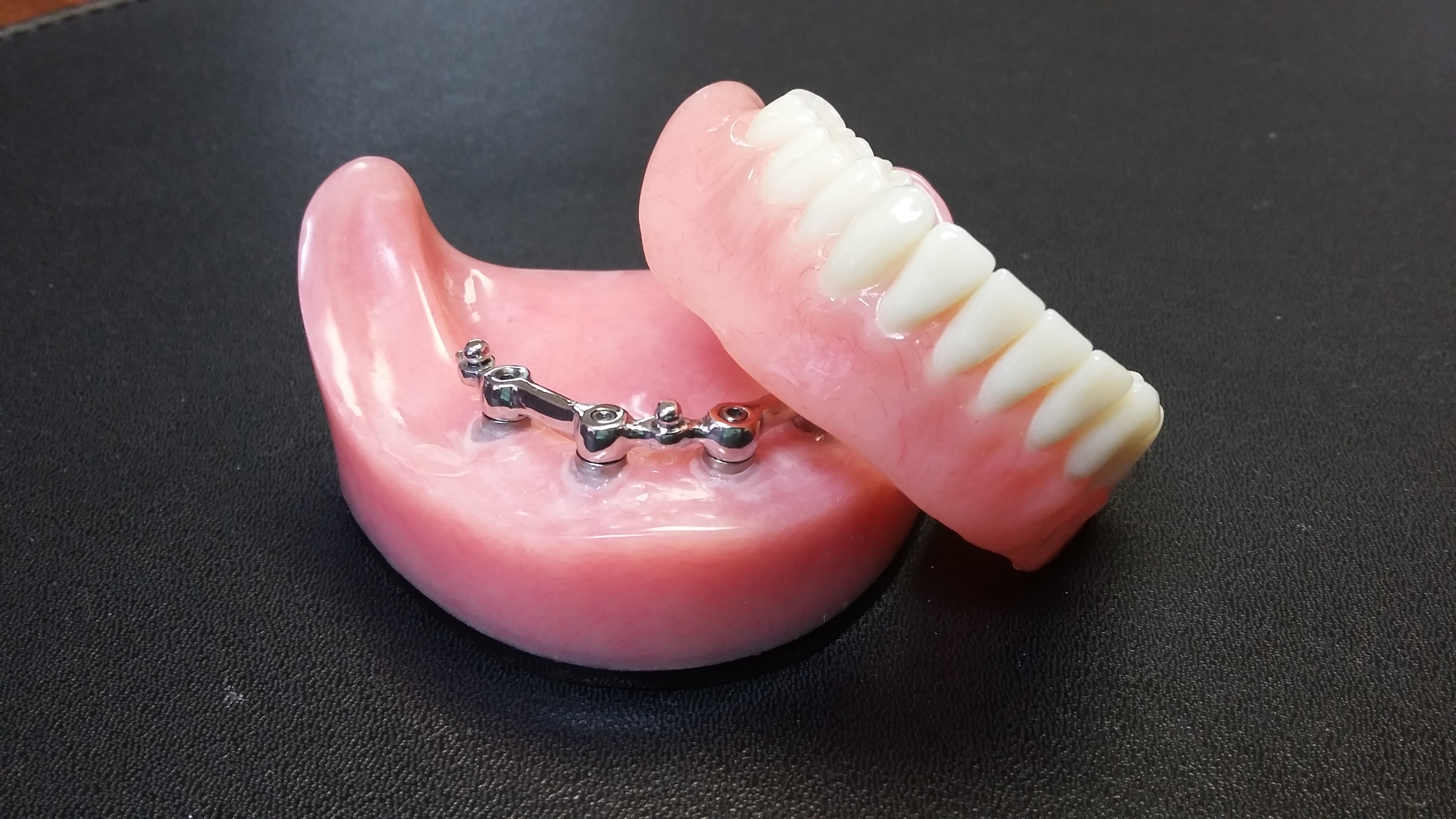 Denturologiste Anjou | Myriam Fortin |prothèse dentaire,dentier