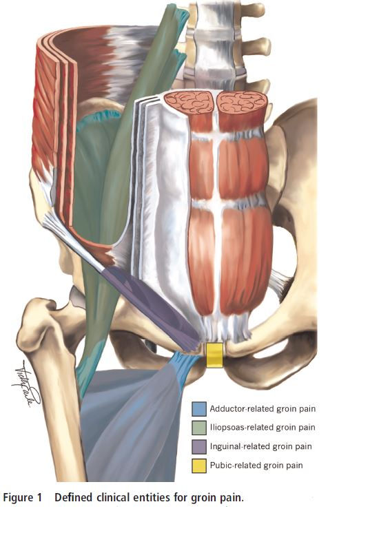 28. All you need to know about Groin Pain.