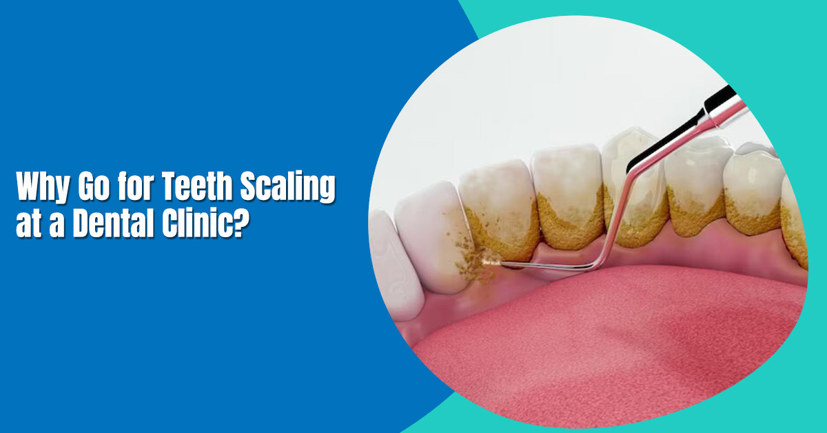 Why Go for Teeth Scaling at a Dental Clinic in Kolkata?