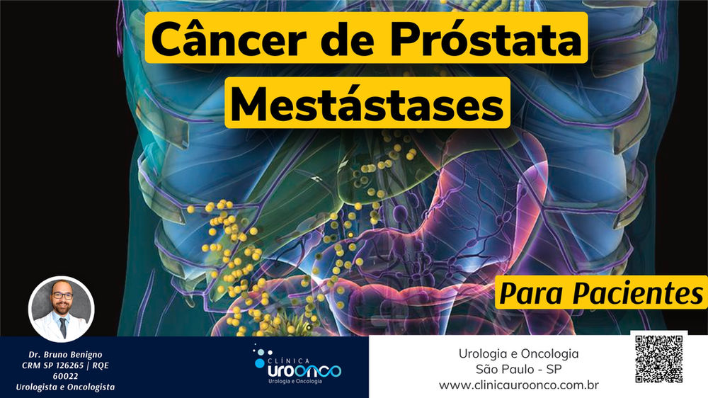 Como saber se tenho câncer de próstata com metástases?