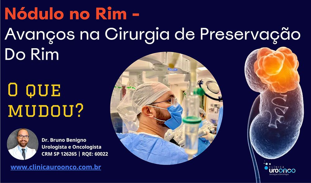 Câncer de Rim: As Melhores Estratégias para Preservar Seu Rim e Evitar ...