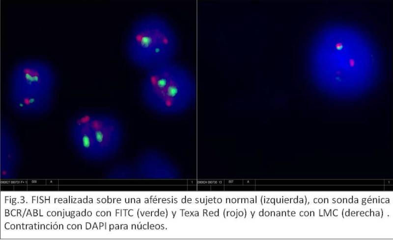 PUESTA A PUNTO DE FISH EN UN LABORATORIO DE INVESTIGACIÓN BÁSICA.….de