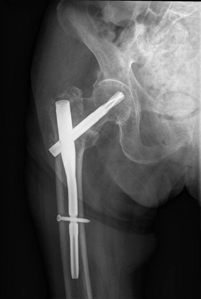 Momentum Orthopaedics