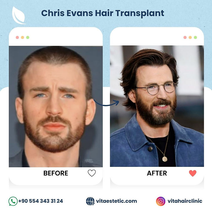 chris evans beard