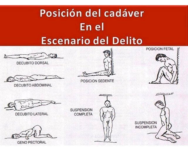 Posiciones cadavéricas