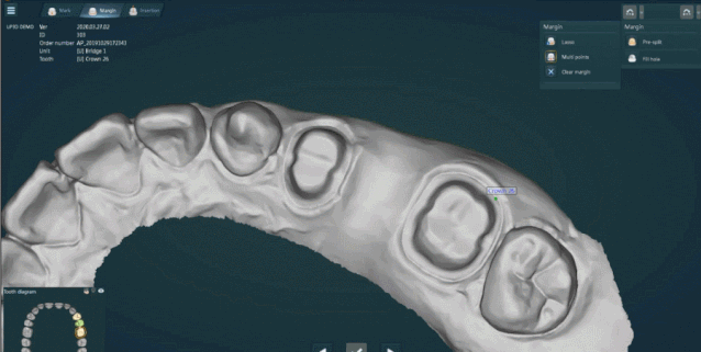 UPCAD Dental CAD Design Software - Up3D | Meditrust