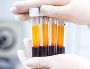 Unraveling the Enigma of “Gold Juice” in Hollywood and Exploring the ...