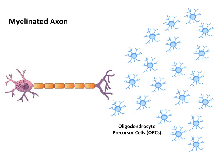 The Challenge and Hope of Myelin Repair