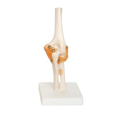 Elbow Joint Anatomical Model | spinecentreuk