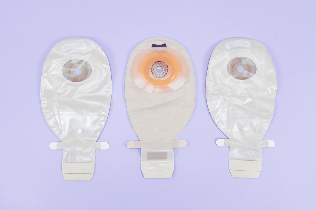 Ileostomy | Asperia Hospital