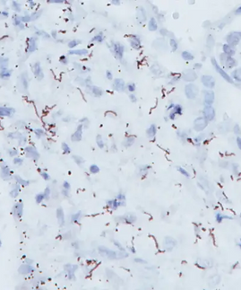 Antibodies | Metagene Pty Ltd