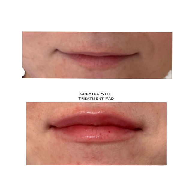 Reviews | Faith Shaw Aesthetics