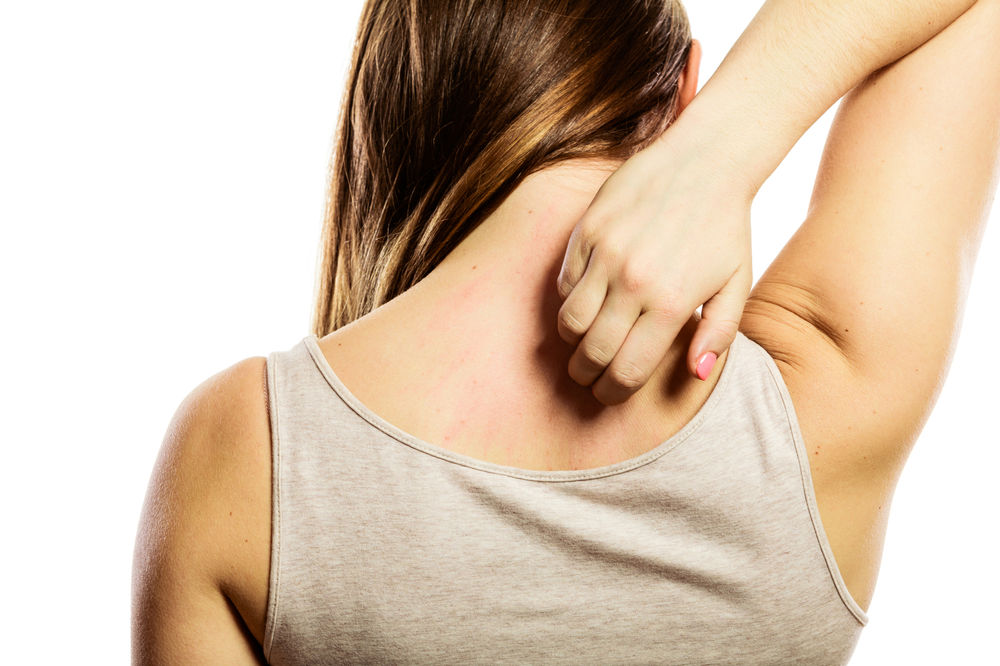 7 Tips To Resolve Shingles Naturally