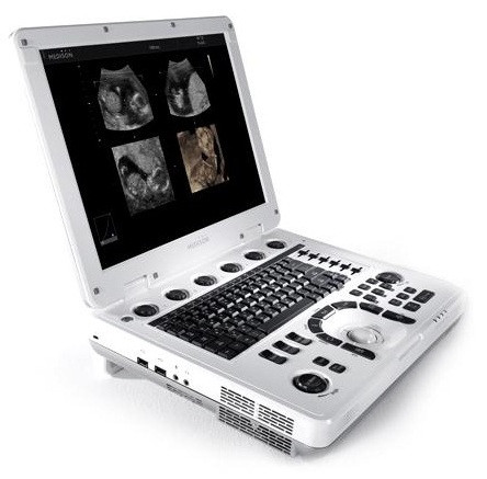 Samsung Medison MySono U6 Portable Ultrasound | hi-techelectromed