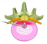 Spine and Joint Pain Center, Modern treatments Naveen Ramineni MD