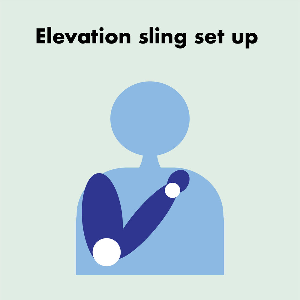 Setting up elevation sling