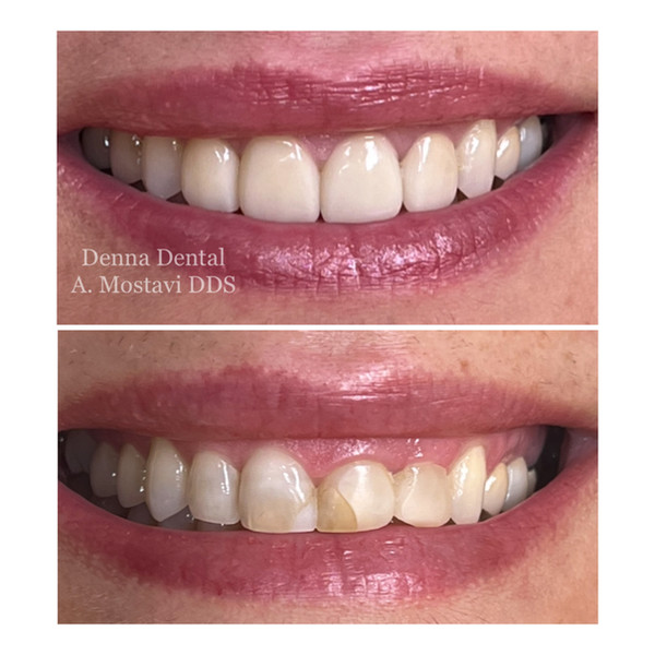 Denna Dental