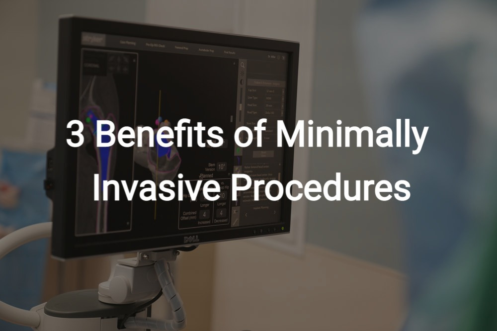 3 Benefits of Minimally Invasive Surgery