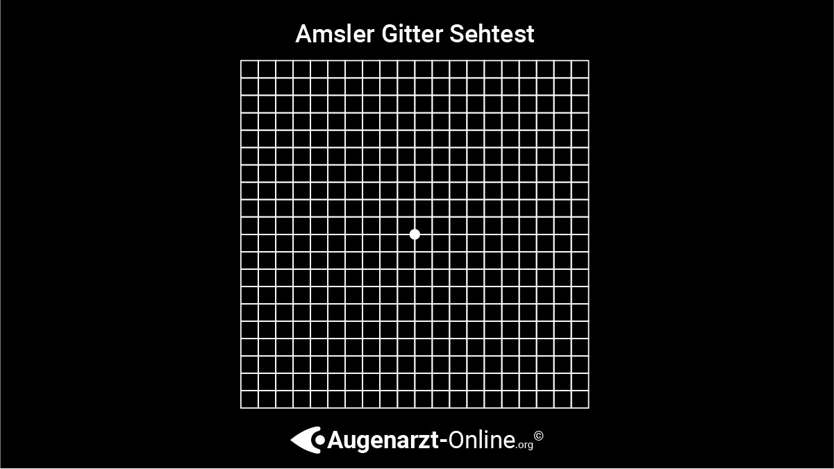 Amsler Gitter | Atlas der Augenheilkunde