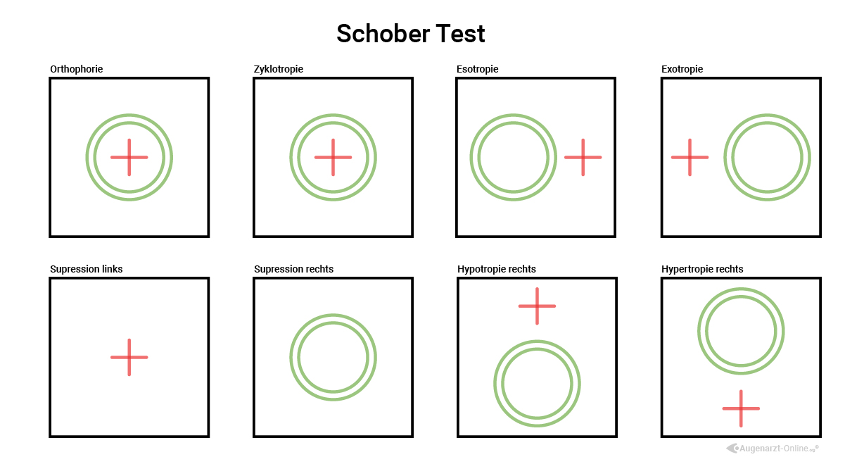 Schober Test