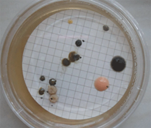 Bioburden Test for Medical Device