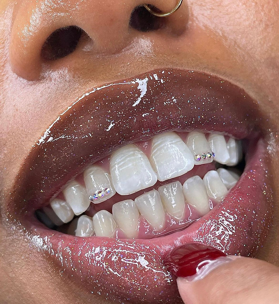 The Gem Trap | DIY Tooth Gem Kits & Courses